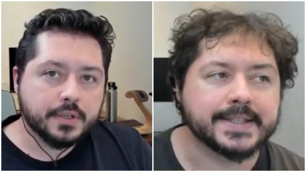 Atila Iamarino faz live sobre já poder sair de casa e web zoa o cabelo dele