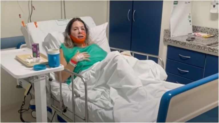 Aline Fuchter passa por reconstrução facial após acidente e tranquiliza fãs