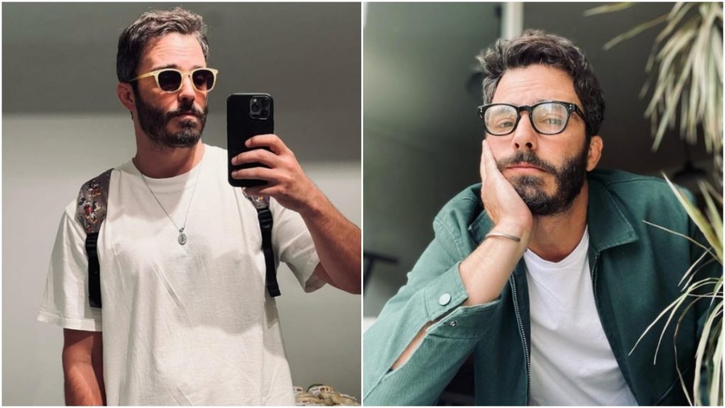 Ator Thiago Rodrigues perde parte do couro cabeludo em assalto