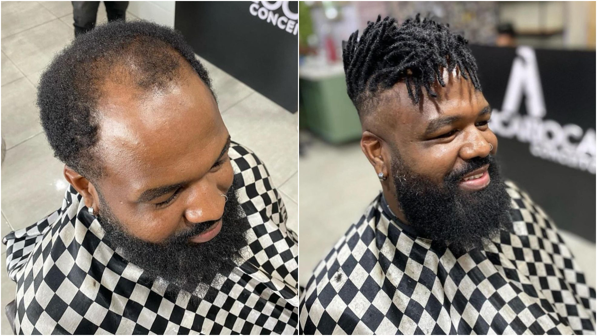 Projeto que faz dreads em calvos chega a Belo Horizonte